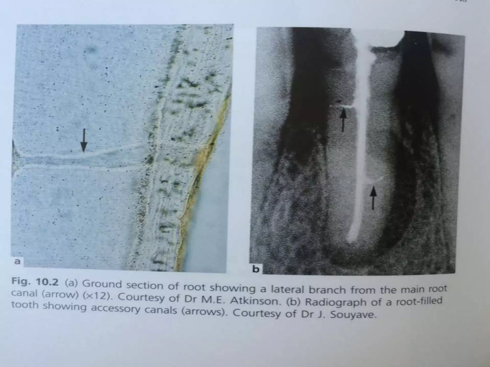 Oral histology - Dental pulp | PPTX