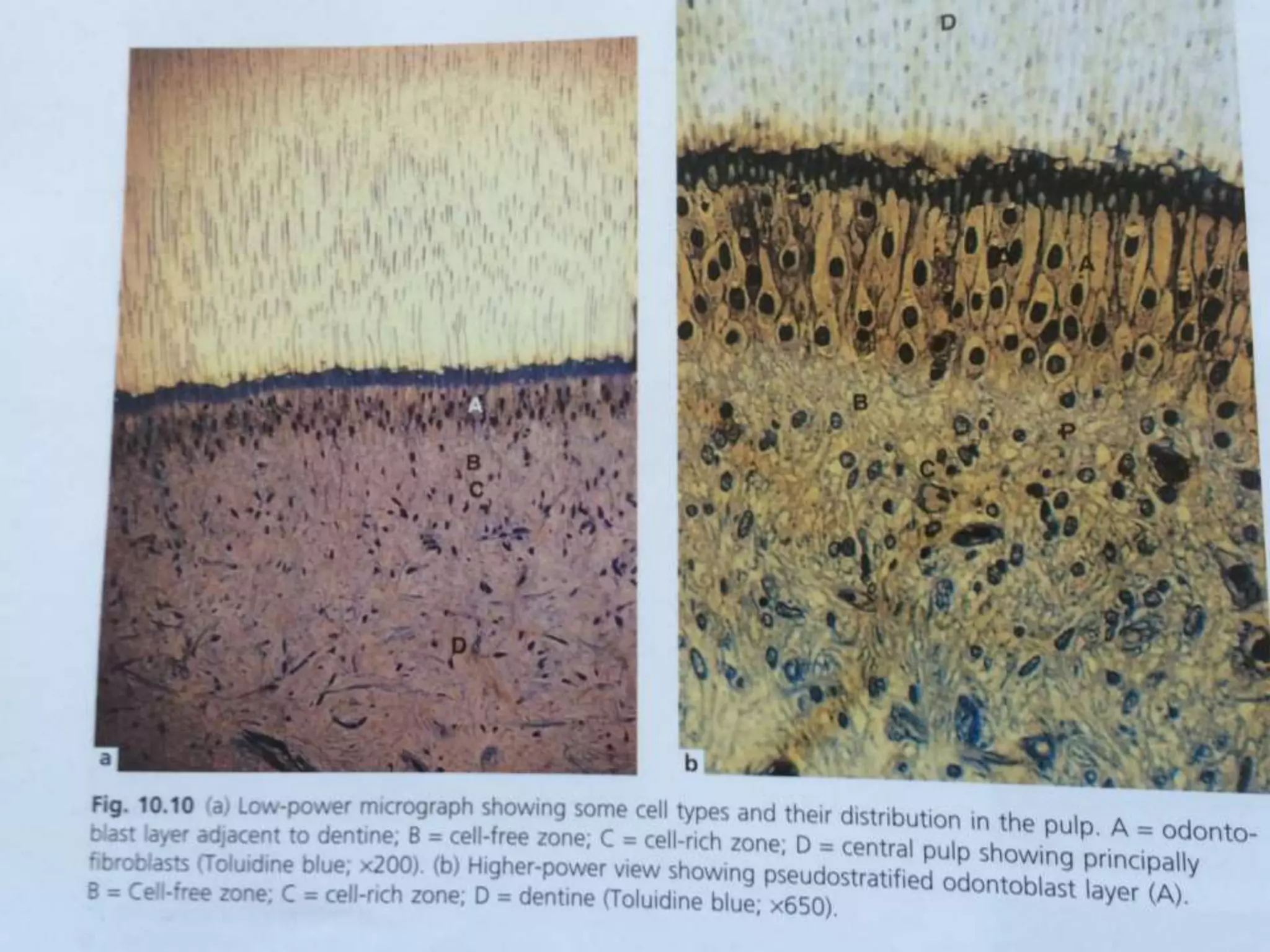 Oral histology - Dental pulp | PPTX
