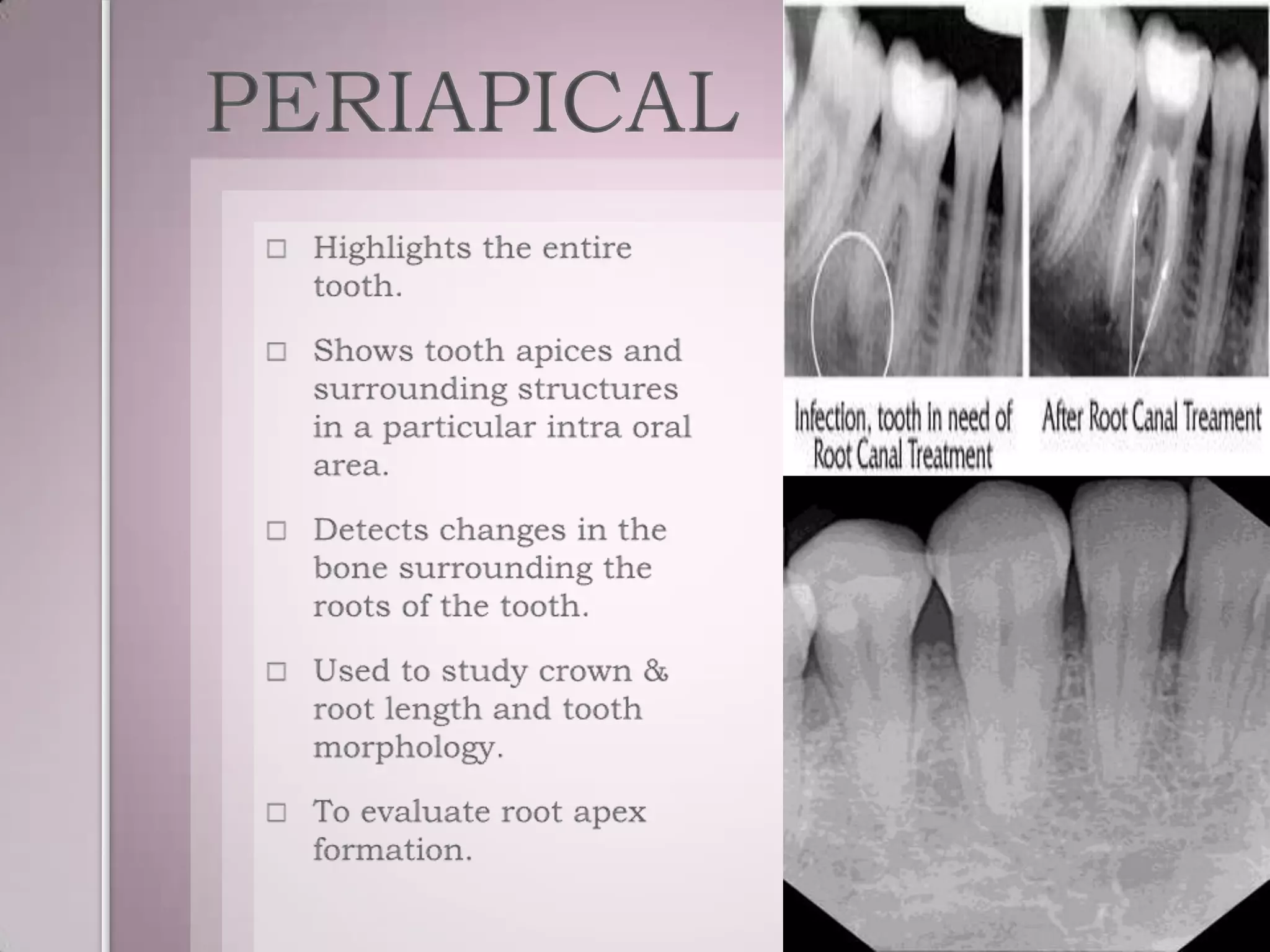 Dental radiography | PPTX