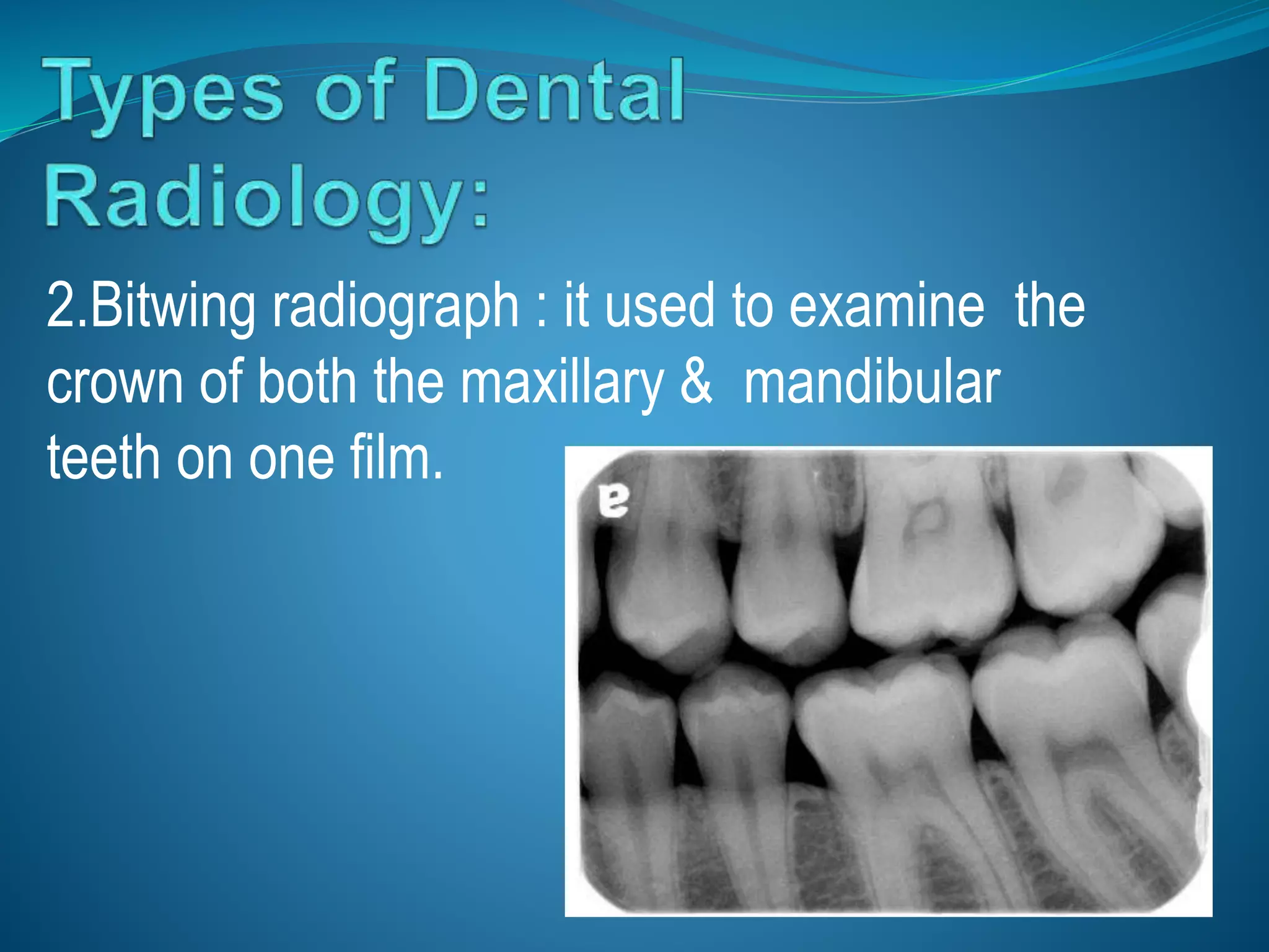 Dental radiology ppt | PPSX