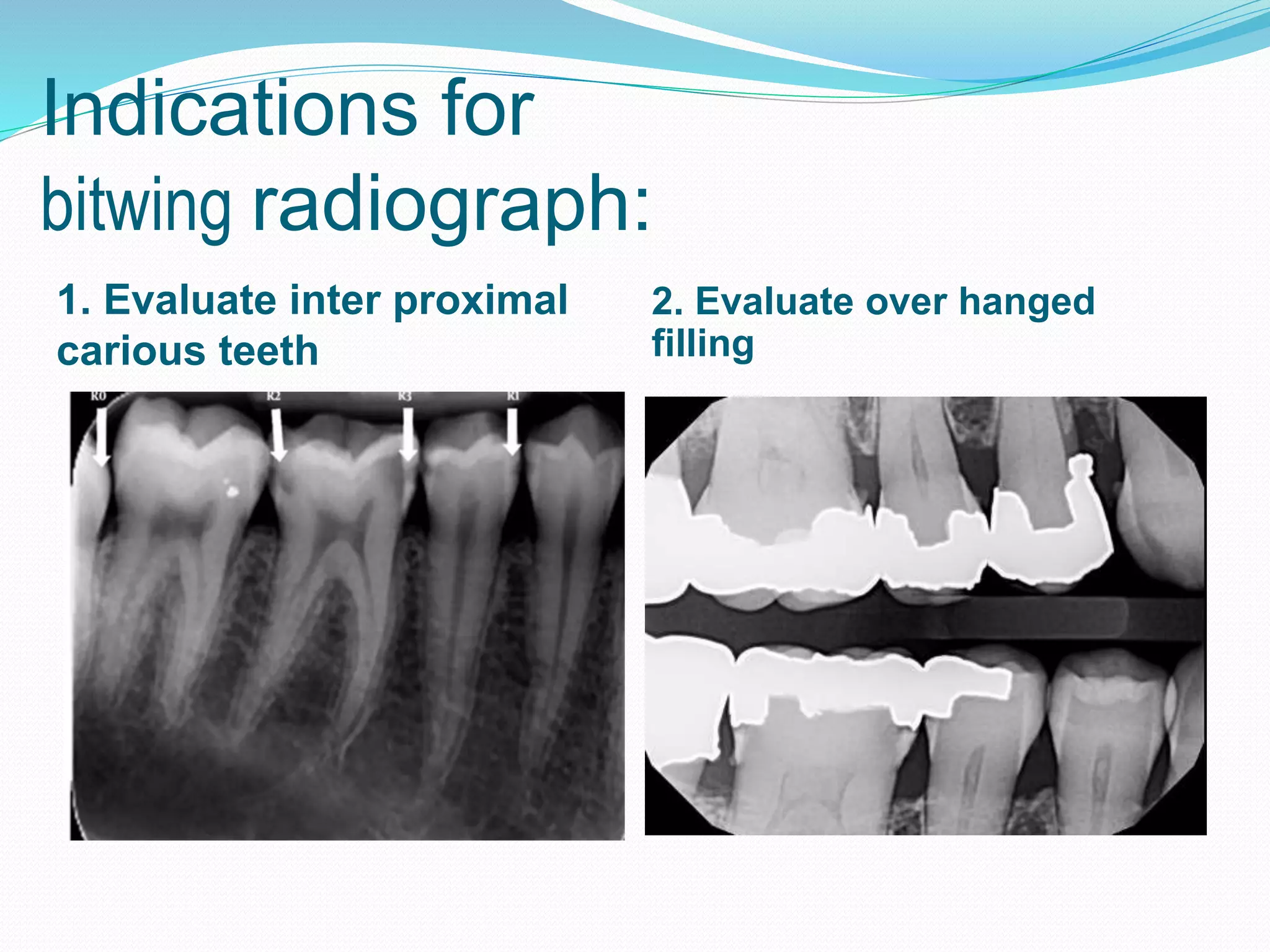 Dental radiology ppt | PPSX