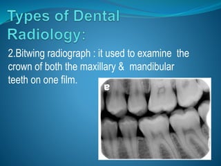 Dental radiology ppt | PPSX