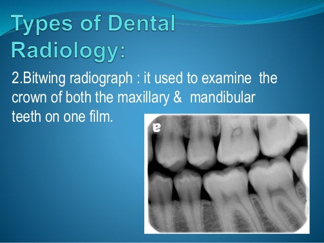 Dental radiology ppt
