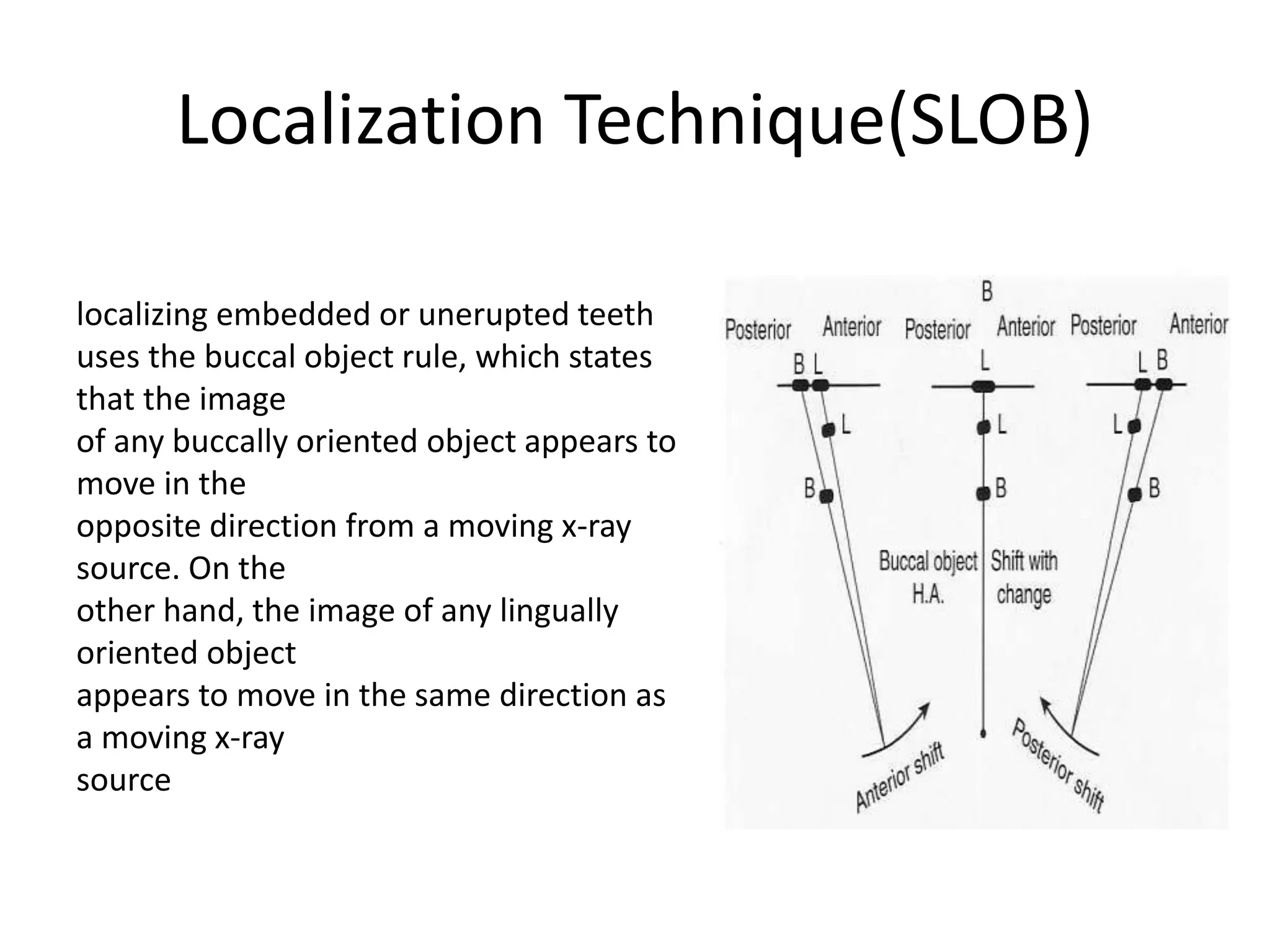 Dental radiology related to pedodontics | PPTX