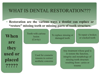 dental restorations.pptx