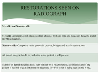 dental restorations.pptx