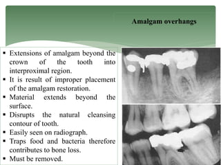 dental restorations.pptx