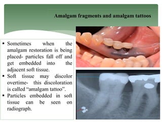 dental restorations.pptx