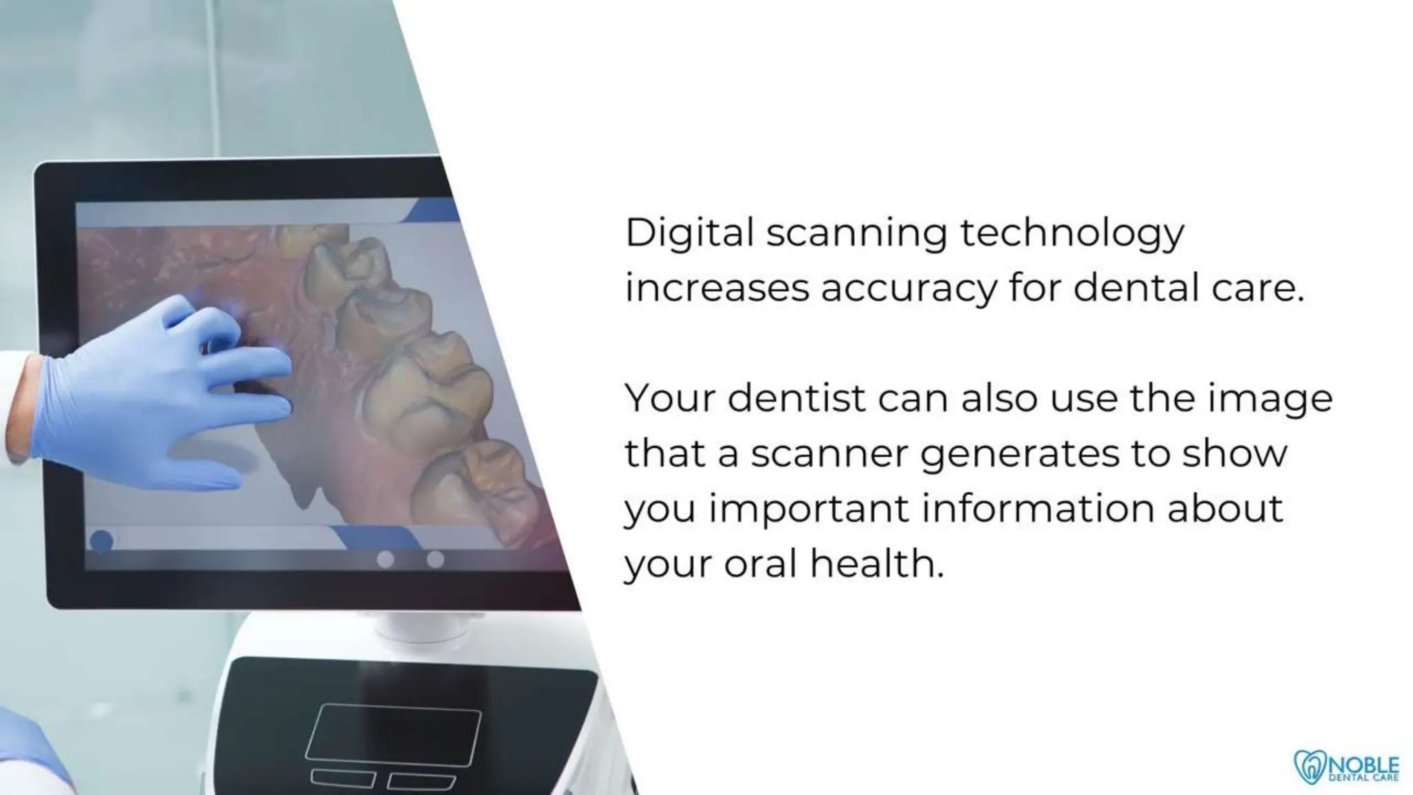 Dental Scanners How They Work | PPTX