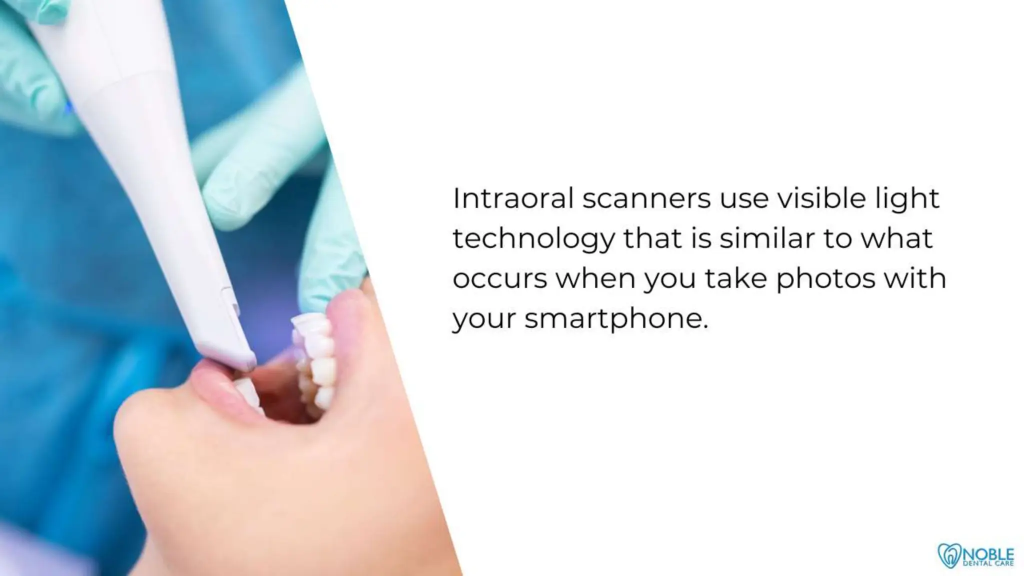 Dental Scanners How They Work | PPTX