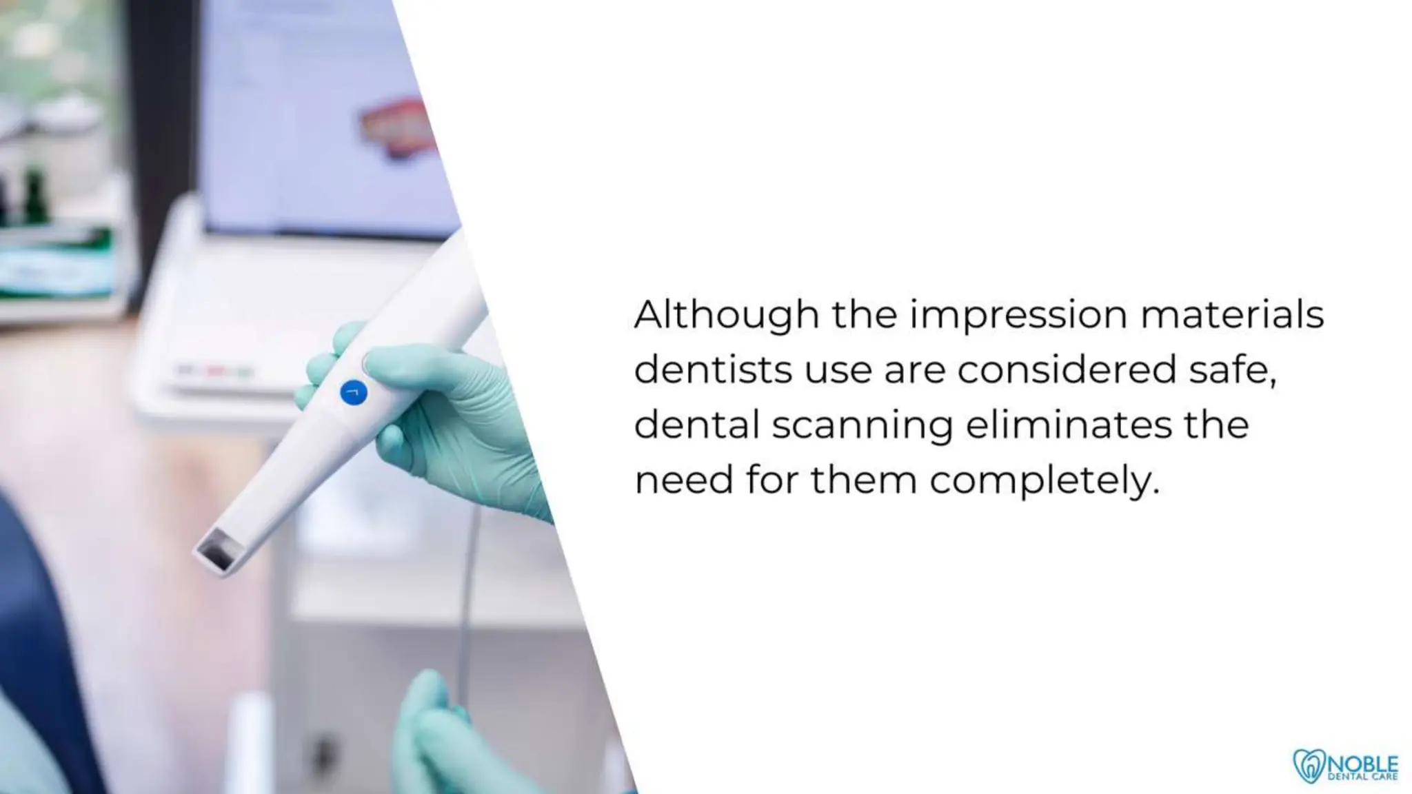 Dental Scanners How They Work | PPTX