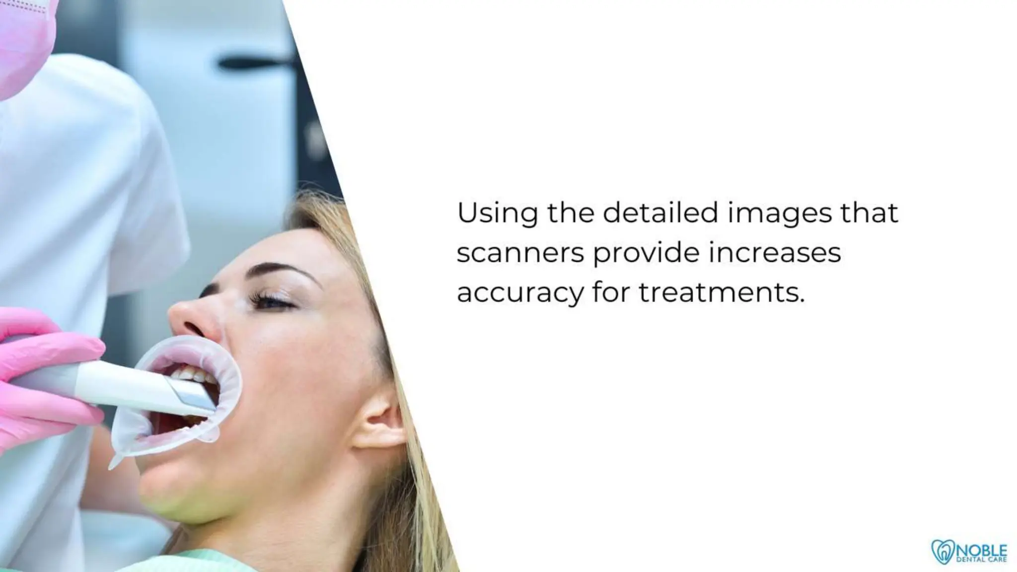 Dental Scanners How They Work | PPTX