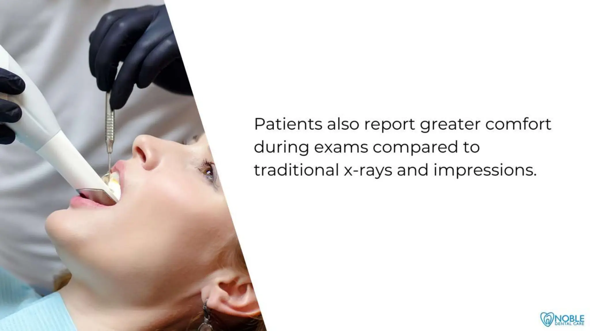 Dental Scanners How They Work | PPTX