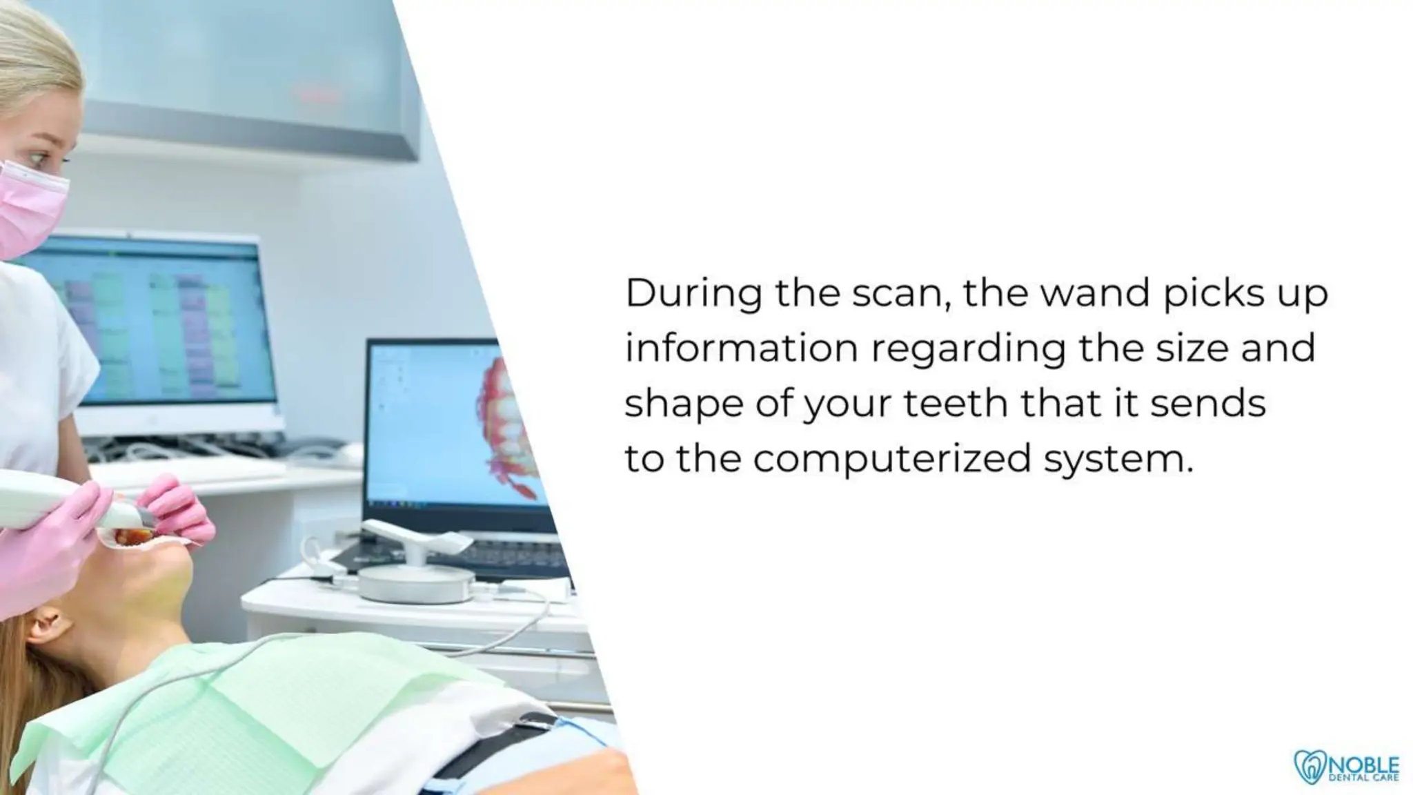 Dental Scanners How They Work | PPTX