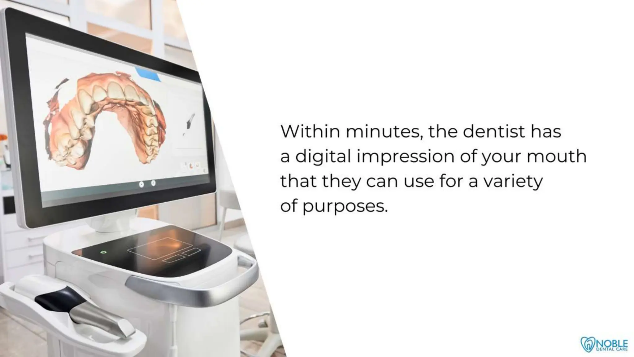 Dental Scanners How They Work | PPTX