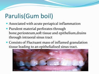 Dental sequalae of pulpitis and management of apical lesions | PPTX