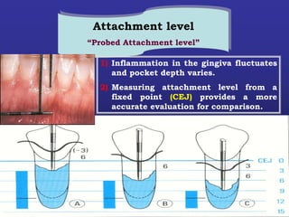 Dental sharting | PPT