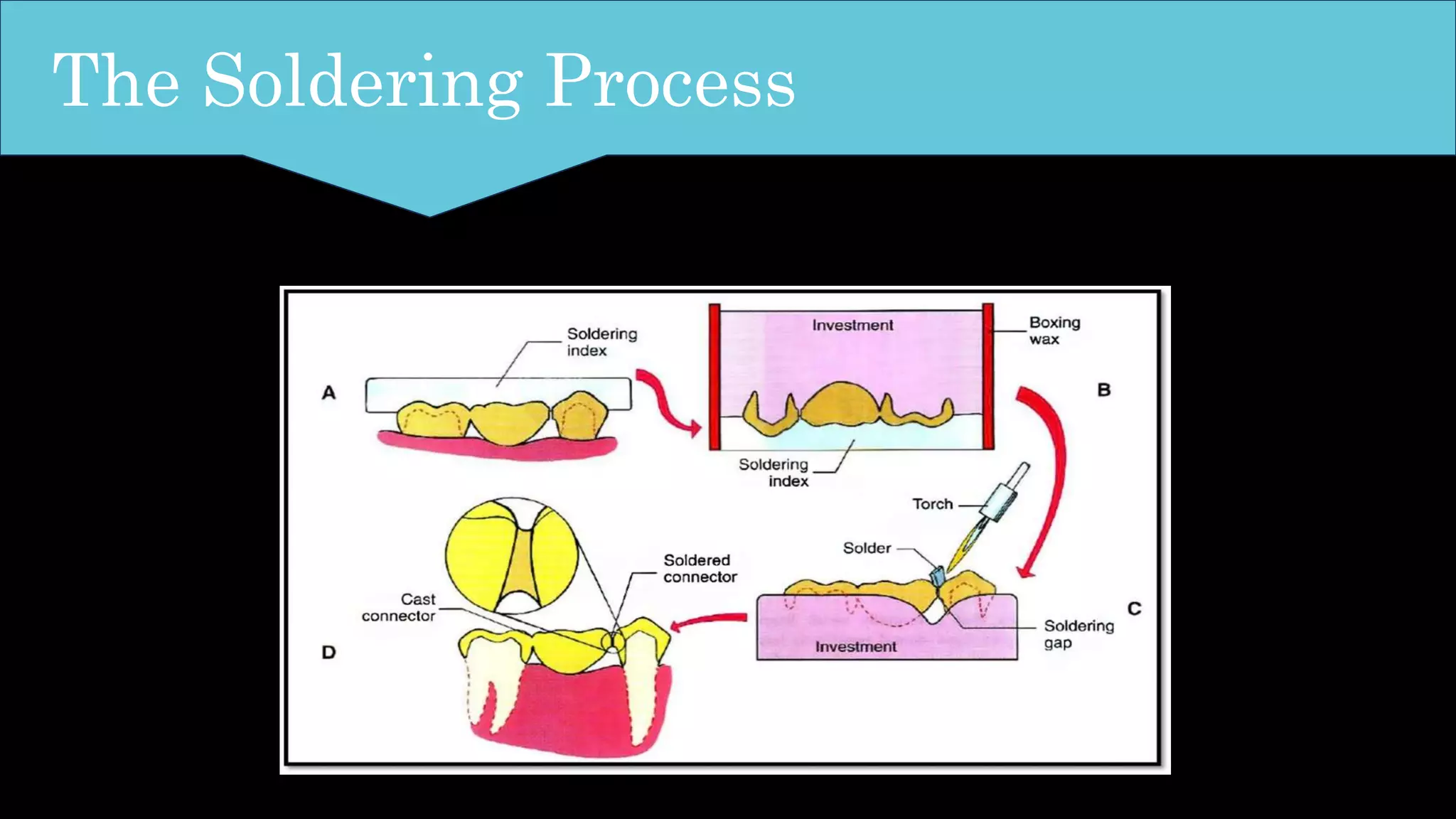 Dental Soldering, Welding and Brazing.pptx