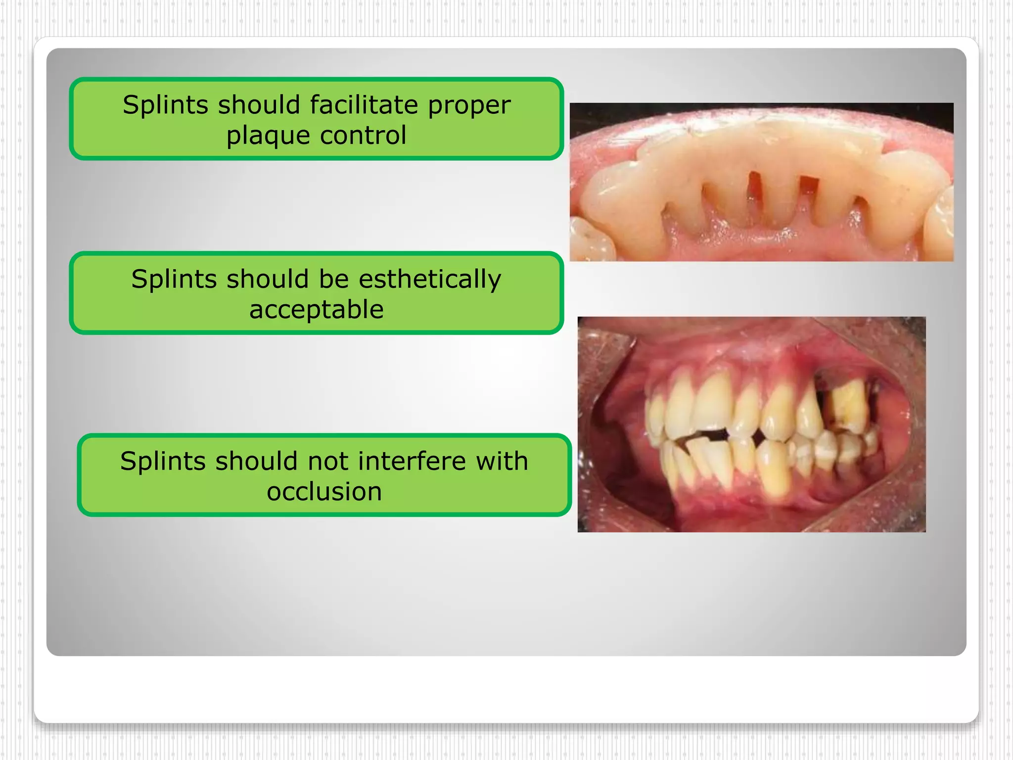 Dental splinting | PPTX