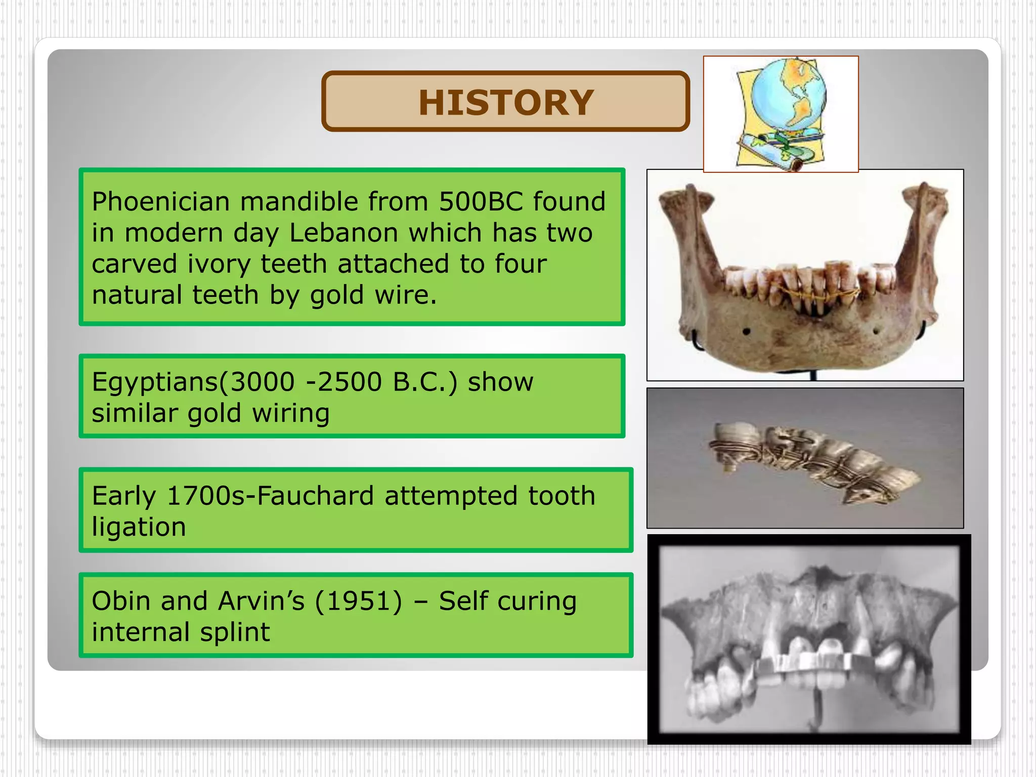 Dental splinting | PPTX
