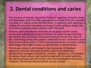 Dental stains | PPT