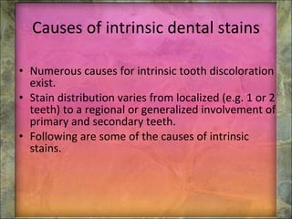 Dental Stains | PPT