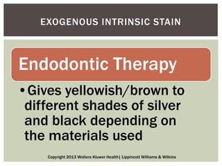 Dental stains, discolorations and polishing | PPSX