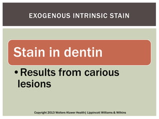 Dental stains, discolorations and polishing | PPSX