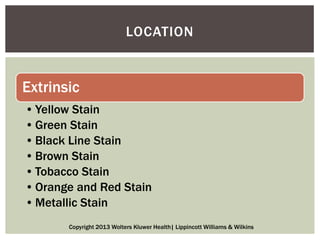 Dental stains, discolorations and polishing | PPSX
