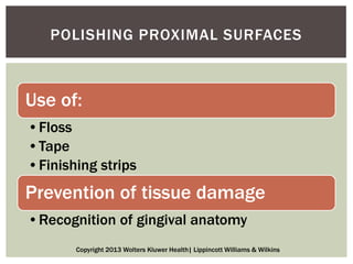 Dental stains, discolorations and polishing | PPSX