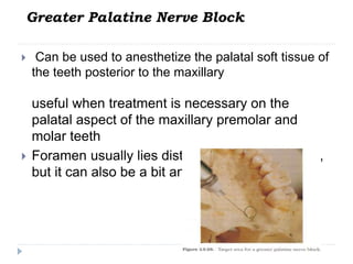 Dental surgery ii | PPT