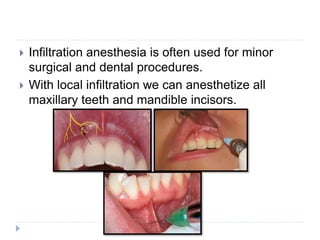 Dental surgery ii | PPT
