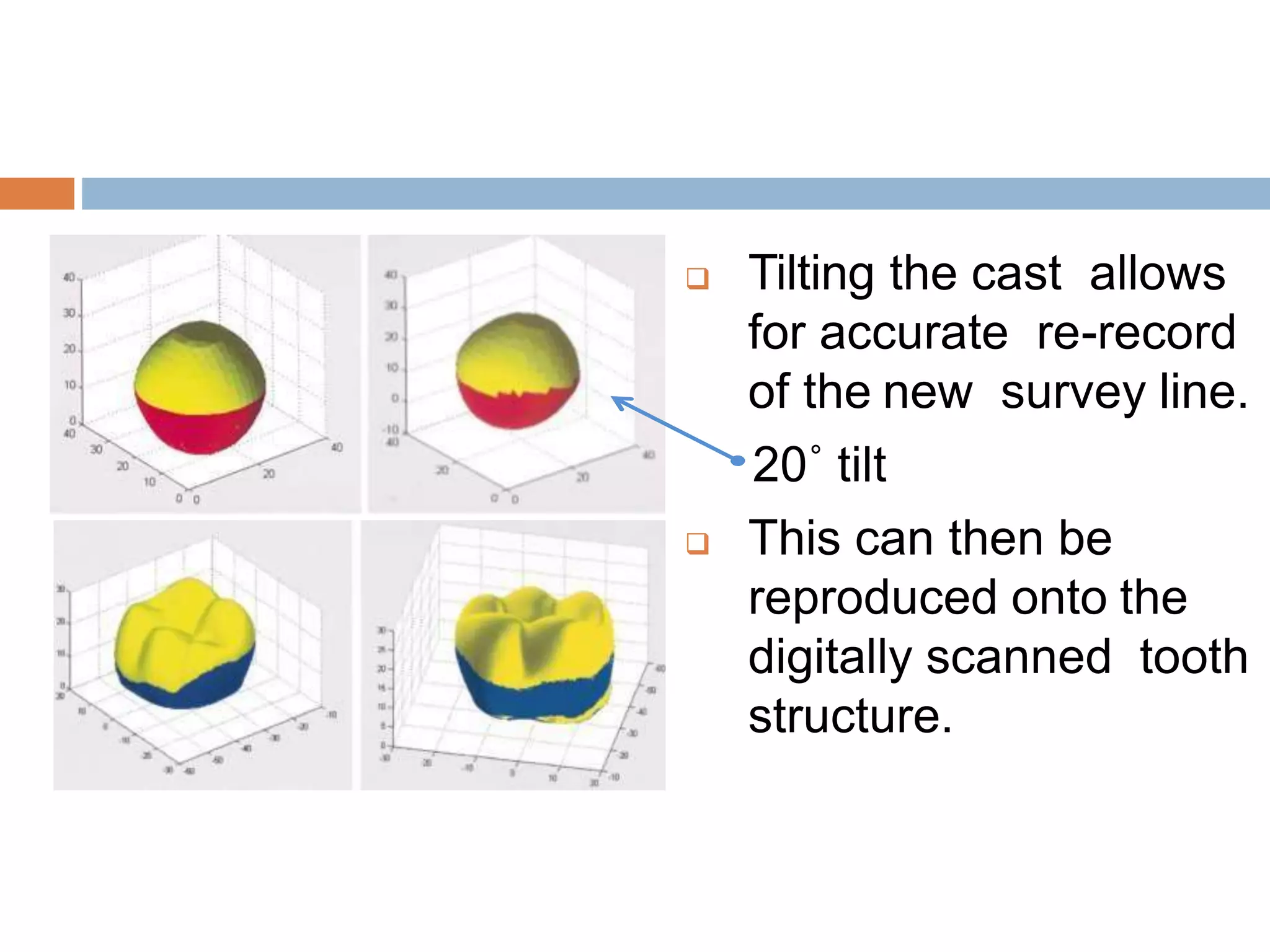 Dental surveyor | PPTX