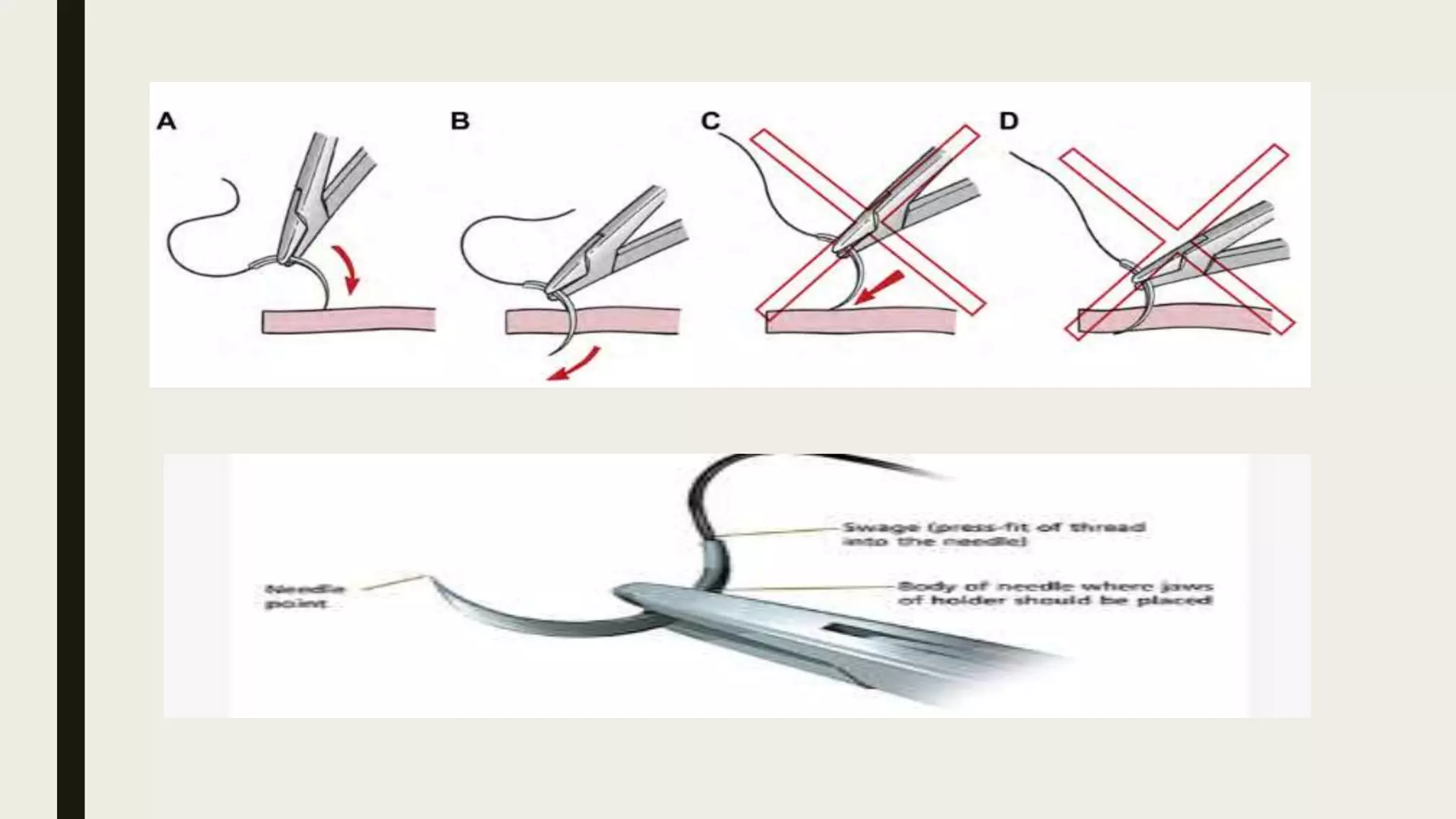 Dental suturing materials and techniques | PPTX