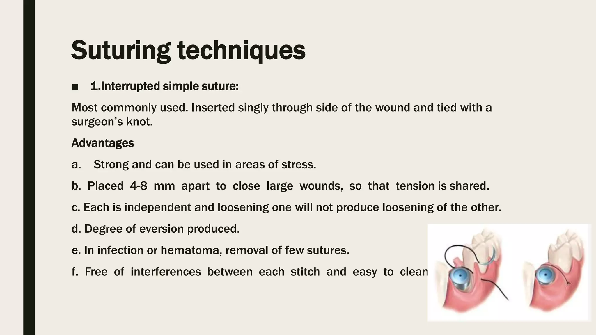 Dental suturing materials and techniques | PPTX