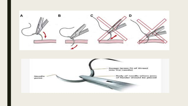 Dental suturing materials and techniques | PPTX