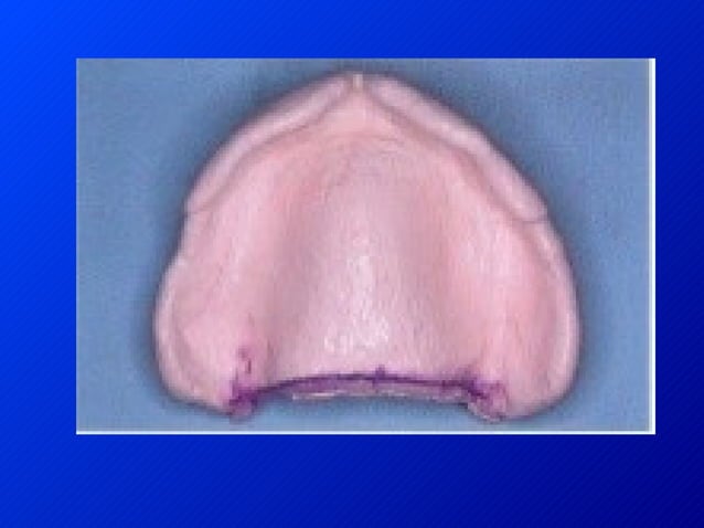 Dental techinatian course | PPT