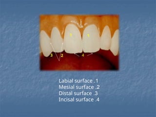 dental terminology and other terminology.pptx