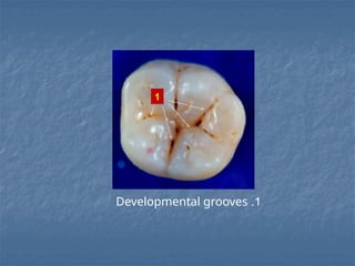 dental terminology and other terminology.pptx