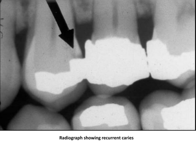 Dental tooth nomenclature | PPTX | Dental Health | Diseases and Conditions