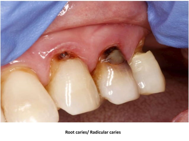 Dental tooth nomenclature | PPTX | Dental Health | Diseases and Conditions