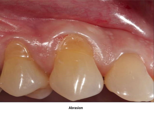 Dental tooth nomenclature | PPTX | Dental Health | Diseases and Conditions