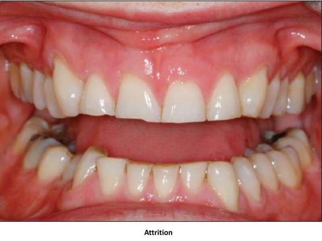 Dental tooth nomenclature | PPTX | Dental Health | Diseases and Conditions