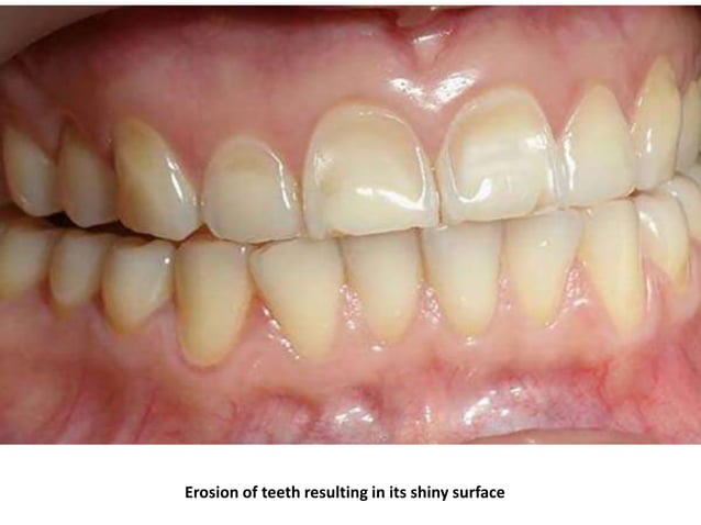 Dental tooth nomenclature | PPTX | Dental Health | Diseases and Conditions