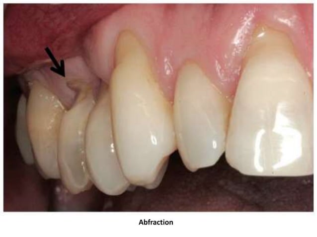 Dental tooth nomenclature | PPTX | Dental Health | Diseases and Conditions