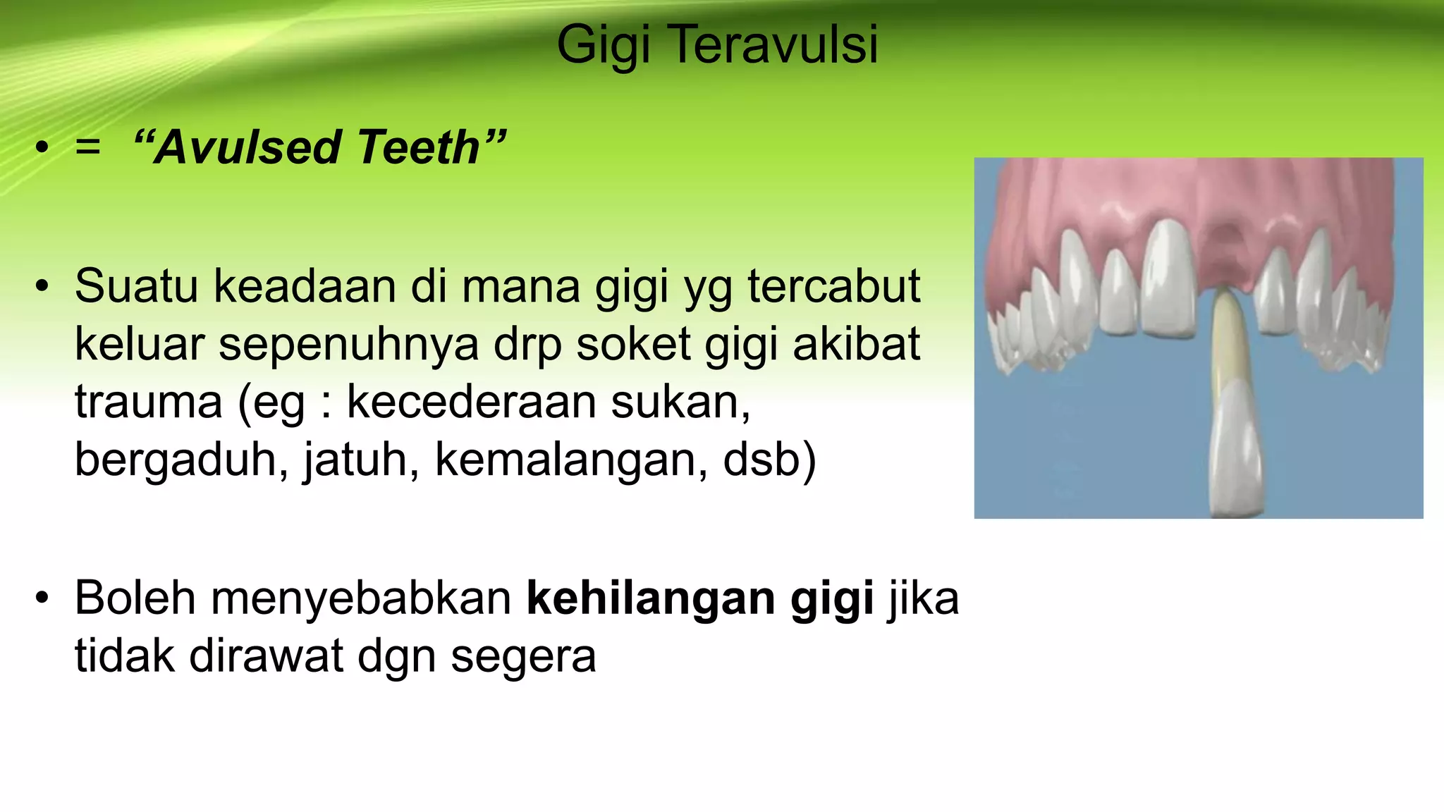 Dental trauma | PPTX