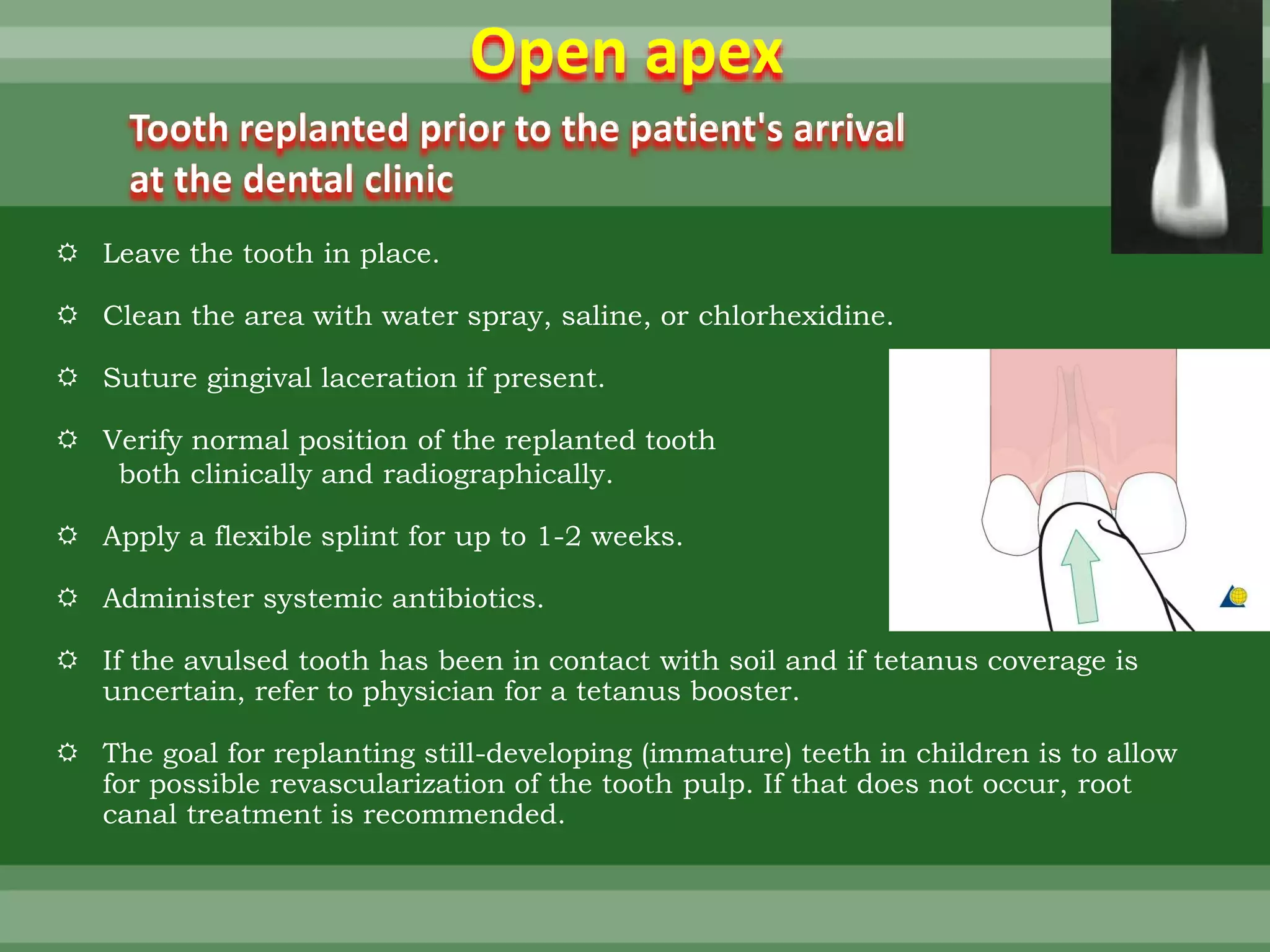 Dental Trauma.pptx
