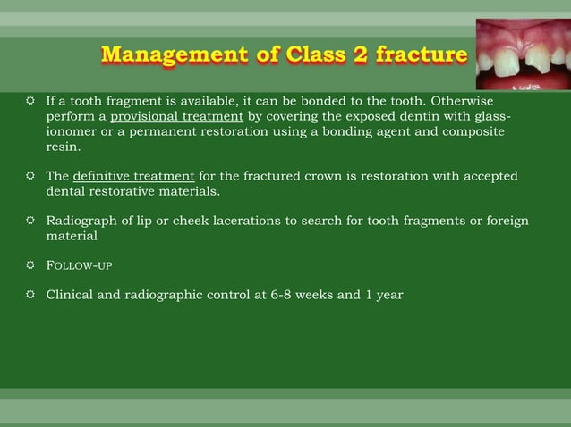 Dental Trauma.pptx | Dental Health | Diseases and Conditions