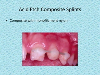 Dental Trauma.ppt