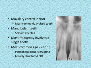 Dental Trauma.ppt